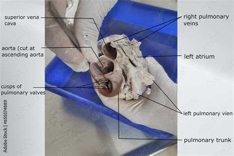 Superior View Of Heart Showing Opening Of Aorta Superior Vena Cava
