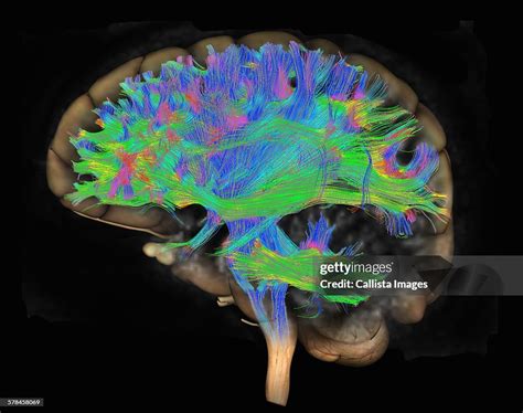 Diffusion Mri Also Referred To As Diffusion Tensor Imaging Or Dti Of The Human Brain High Res
