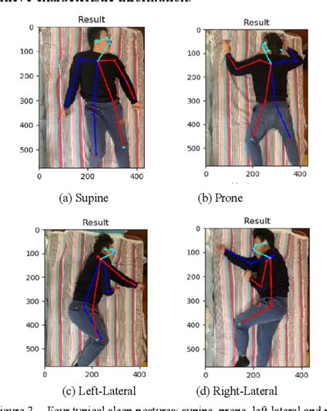 Figure 1 From Skeleton Based Sleep Posture Recognition With Bp Neural