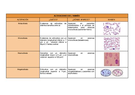 Tabla Alteraciones TAMANO De ERITROCITOS Pdf