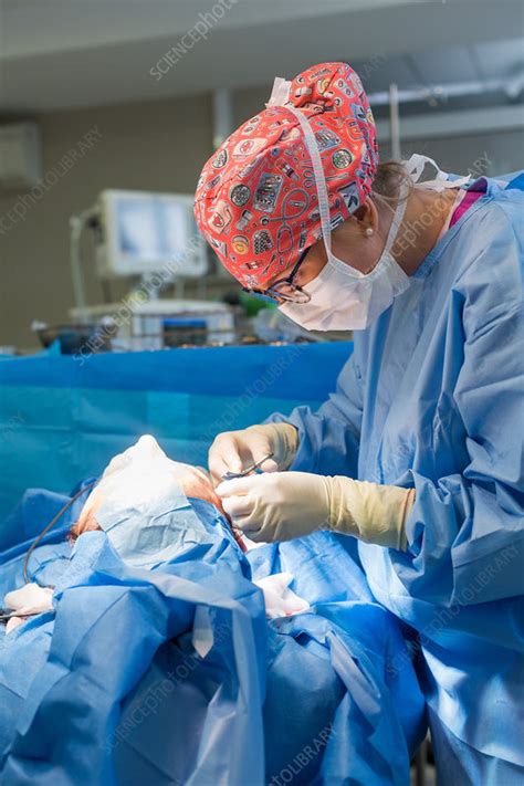 Blepharoplasty Stock Image C049 9410 Science Photo Library