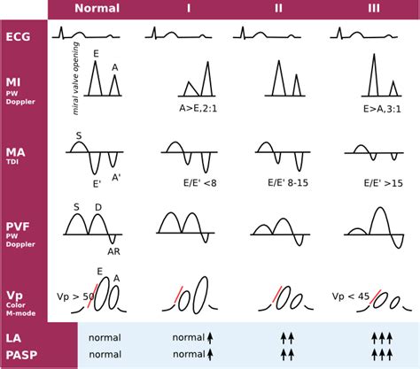 Diastolic Function Grading Schematic Diastolic Filling Grepmed