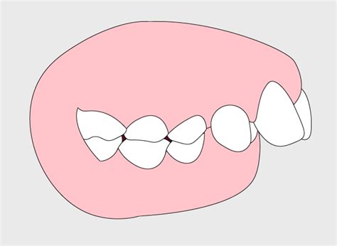 Common Orthodontics Issues