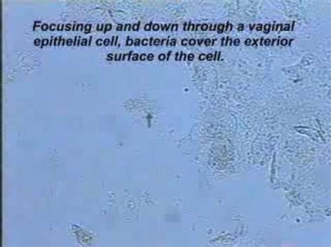 Bacterial Vaginosis Clue Cells Youtube