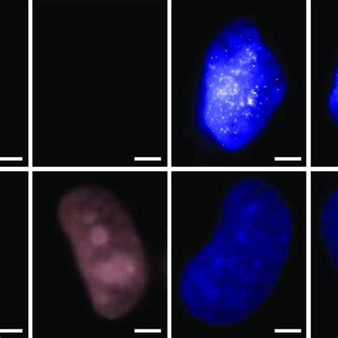 Membrane Poration And Dna Replication A Representative Fluorescence