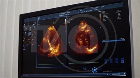 Они рядом паразиты которых мы не замечаем но они нас разрушают ТИА