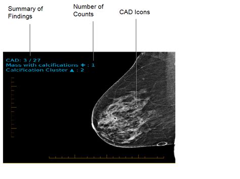 Displaying Genius AI CAD On D Images