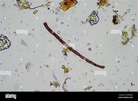 Soil Sample Under The Microscope Soil Fungi And Microorganisms Cycling