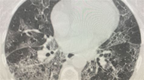 What Are The Safety Concerns On CT Scan HAMDARD IMGAING CENTRE