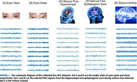 figure 2 from deep c lstm neural network for epileptic seizure and