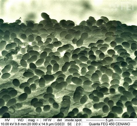 Enterococcus Faecalis Community Enterococcus Faecalis Colo… Flickr