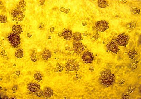 Imageafrican Swine Fever Virus Hemadsorption Merck Veterinary Manual