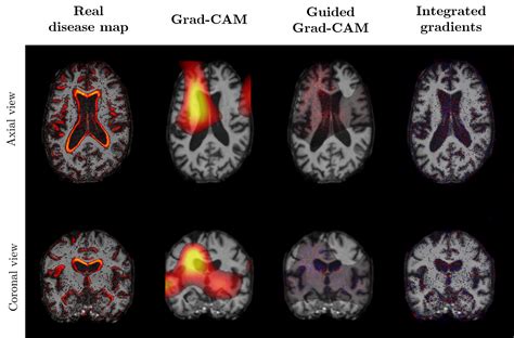 Interpretable Deep Learning Part Ii Visual Interpretability With