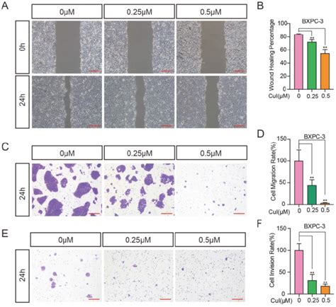 Cui Suppressed The Migration And Invasion Of Pdac A Bxpc 3 Cell