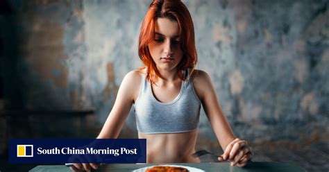 Beating Anorexia What Causes The Eating Disorder And How To Support