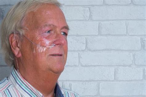 Acid Reflux And Acid Indigestion Testing Photos By Canva