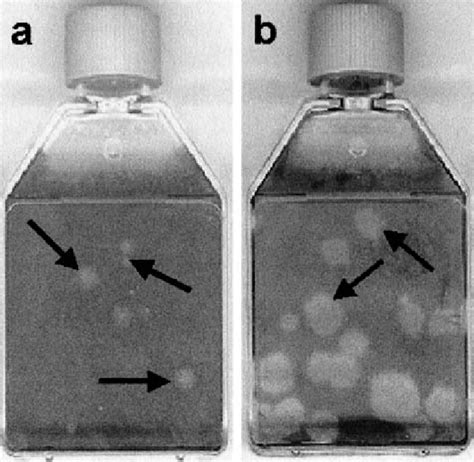 Polystyrene Tissue Culture Flask At Garry Beckwith Blog