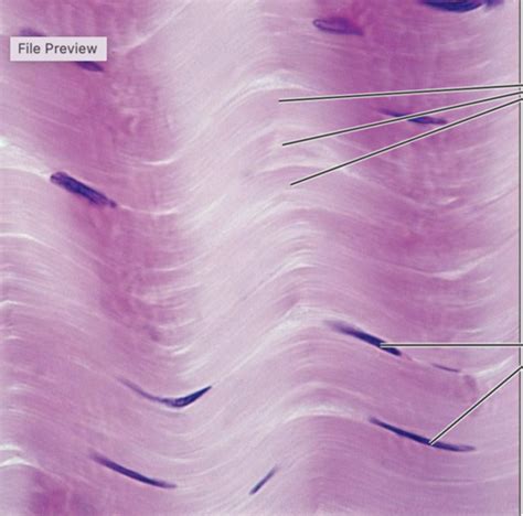 Histology Lab Connective Tissue Flashcards Quizlet