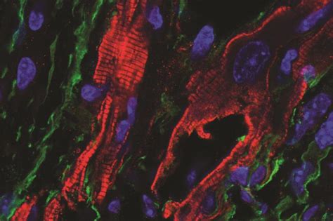 Research On Cardiac Fibroblasts May Have “profound Impact” For