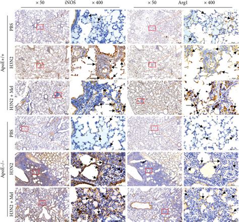 The Blocking Of The Apoe Ldlr Pathway Suppressed The Regulation Of