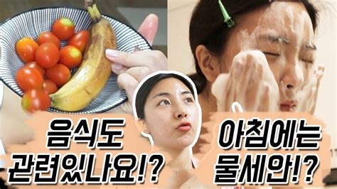 여드름에 대한 오해와 진실⁉️ 28년 여드름 피부가 답변드려요 Youtube