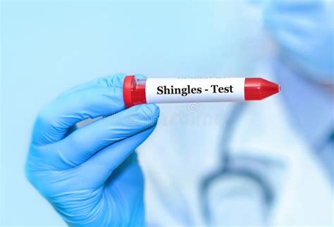 Doctor Holding A Test Blood Sample Tube Positive With Shingles Test