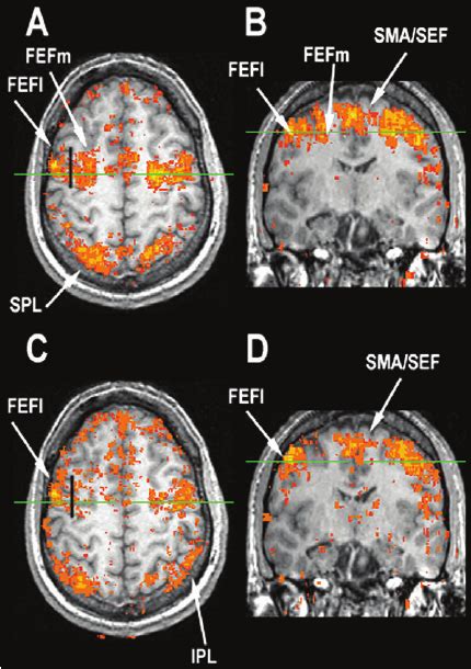 Distribution Of Task Related Activity In Frontal Fef Sef And Download Scientific Diagram