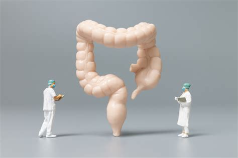 Ulcerative Proctitis Vs Colitis Symptoms Causes And Key Differences