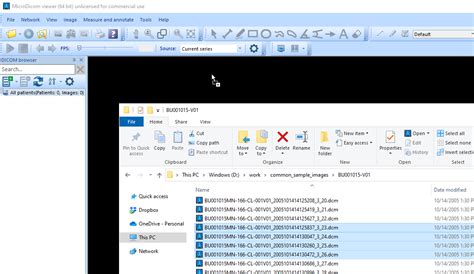 Open A Dicom File