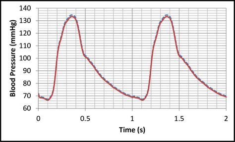 Validation Of Pressure Wave Forms Locationed At The Renal Artery