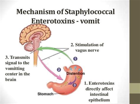 Staphylococcal Food Poisoning