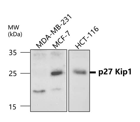 P27 Kip1 Antibody Ir123 314 Ireal Biotechnology Inc