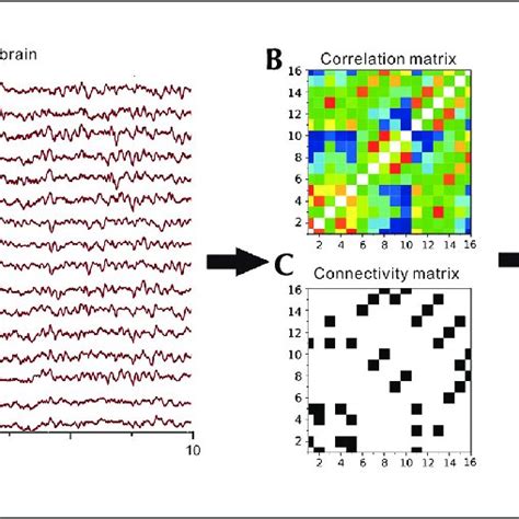 Pdf The Brain As A Complex Network Assessment Of Eeg Based Functional Connectivity Patterns