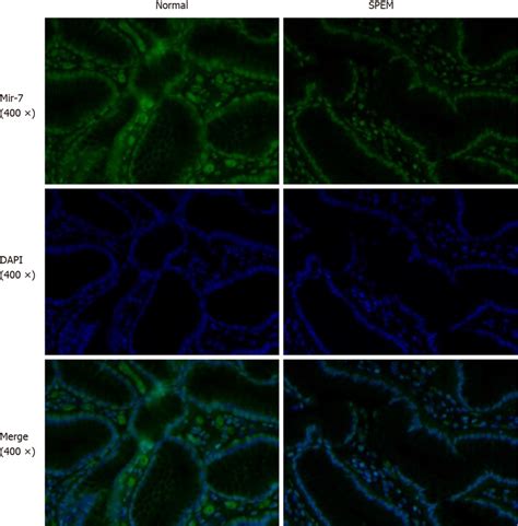 Fluorescence In Situ Hybridization Analysis Of Microrna 7 Expression In Download Scientific