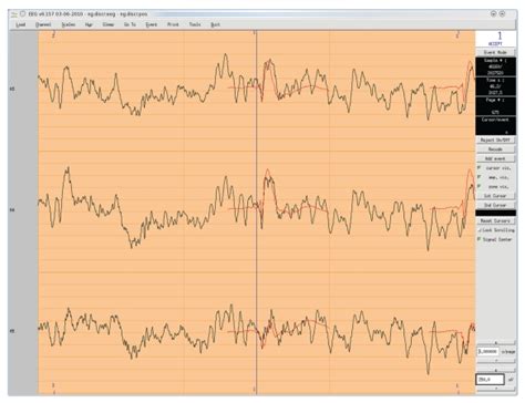 EEG Vizualisation Tool For Continuous Data Eeg File With An Example Download Scientific