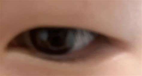 의사에게 물어보세요 쌍커풀 어떤 라인이 강남언니 1등 성형수술and피부시술 정보앱