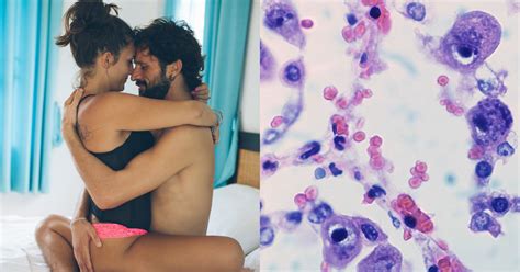 5 Sexually Transmitted Diseases You Should Know About ATTN