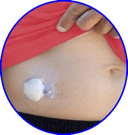 Sensor And Transmitter Support Sensor Signal Not Found