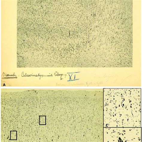 Korbinian Brodmann 17 November 1868 22 August 1918 With Permission Download Scientific
