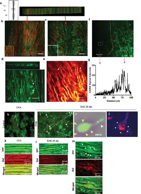 Combination Cars And Reflectance Demonstrate Axonal Dysfunction And