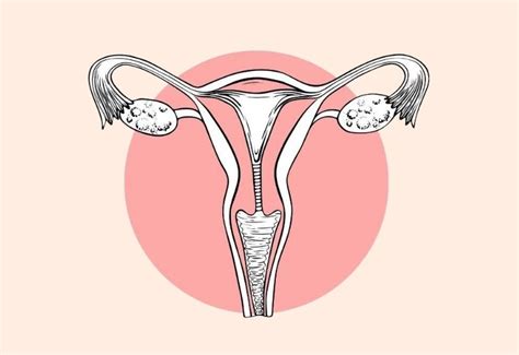 Ovarian Hyperstimulation Syndrome Symptoms And Causes