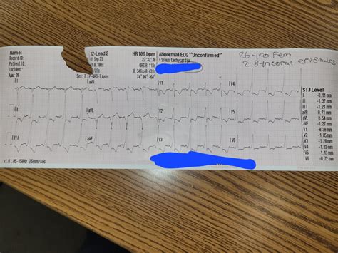 26f 2 Syncopal Episodes Rekgs