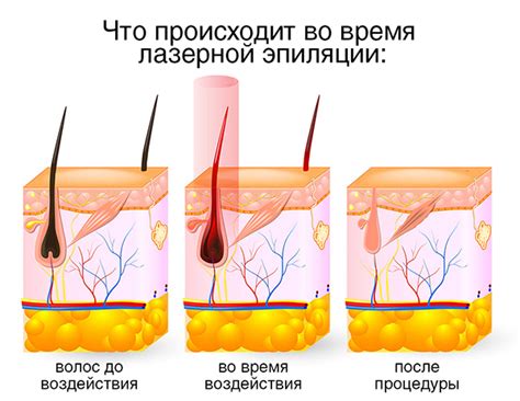 Типы волос на теле и лице