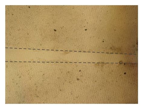 Wound Healing Assay With Hacat Cells Displaying The Increased Cell