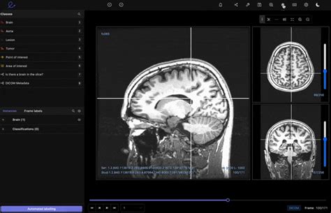 top 7 features you need in a dicom annotation tool