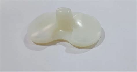 Knee Component Tibial Insert At Rs 20000 Tkr Implants In Ahmedabad