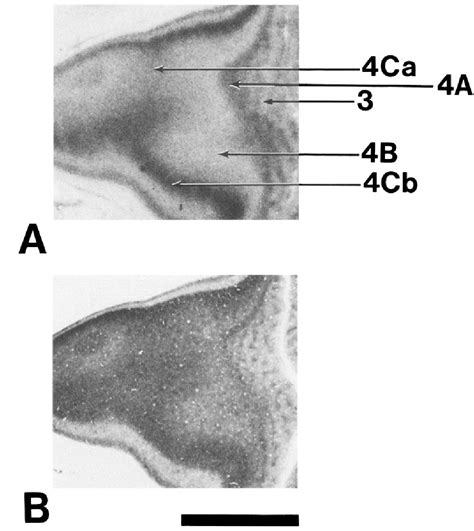 Figure 5 From Functional Anatomy Of Macaque Striate Cortex V Spatial