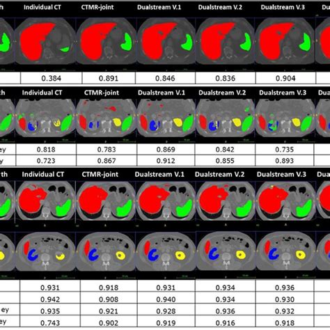 Resunet Dual‐model Architectures Download Scientific Diagram