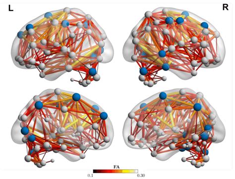 Visualisation Of The Group Average Structural Connectome The Left Download Scientific Diagram