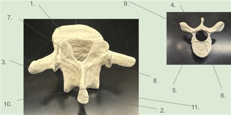 Typical Vertebra Diagram Quizlet
